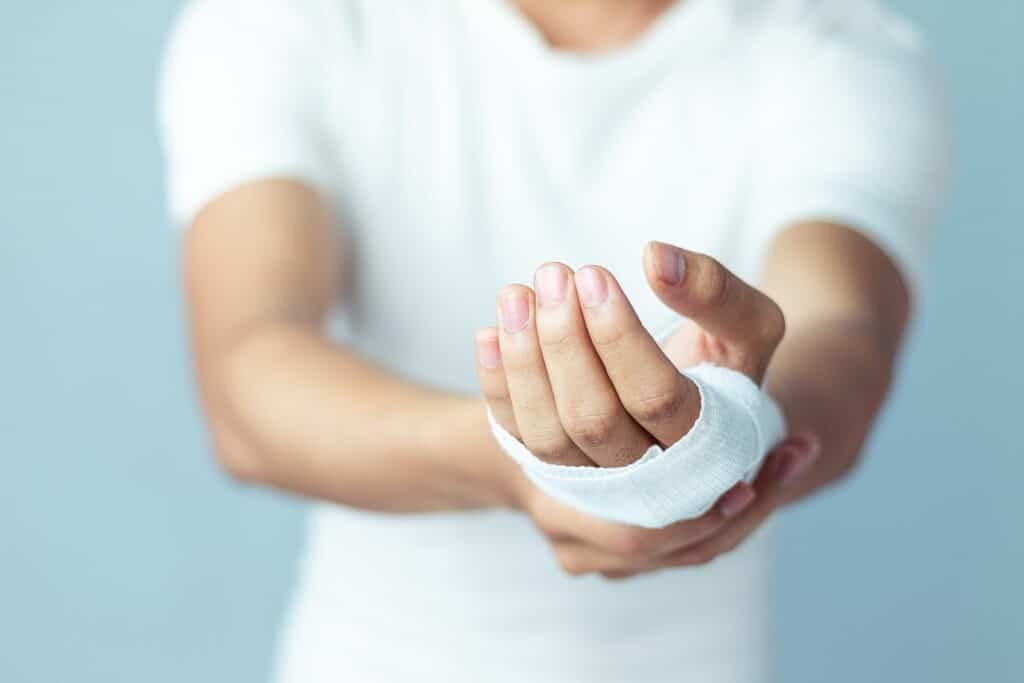 First Steps to Take After a Serious Hand Injury - Grand Rapids, MI